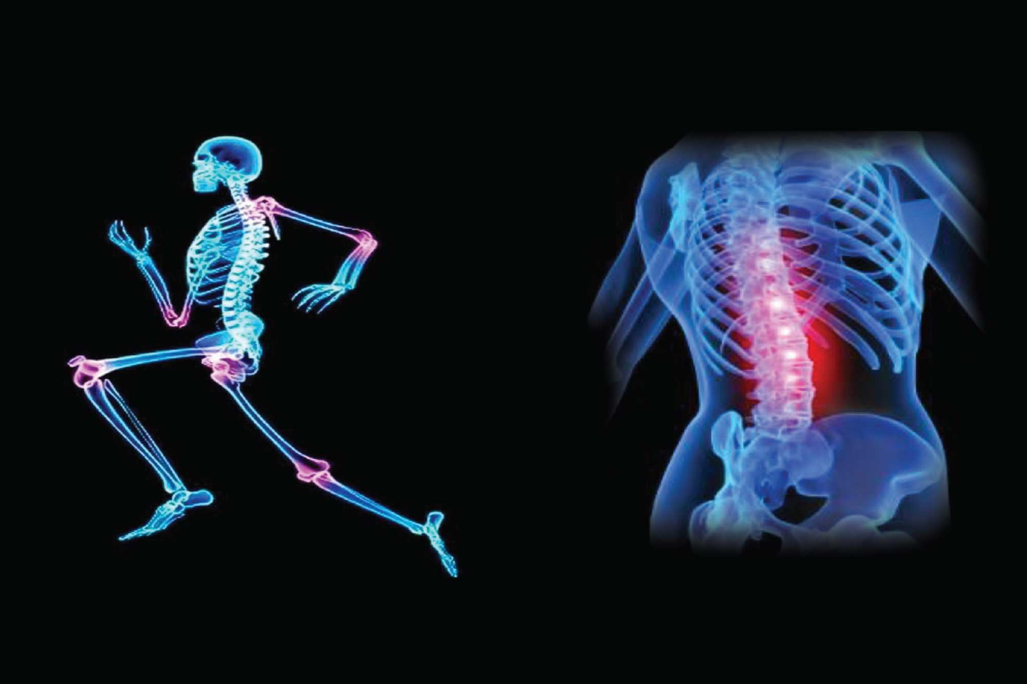 Delaying Joint And Bone Problems Through Integrative Medicine Delaying Joint And Bone Problems Through Integrative Medicine